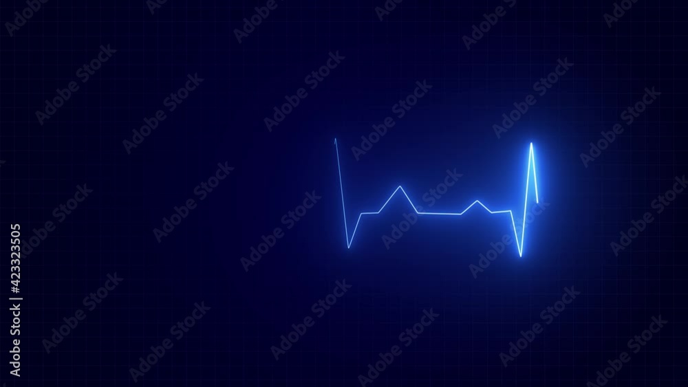EKG, ECG curve. Pulse measuring heart beat rate cardio monitor Loop ...