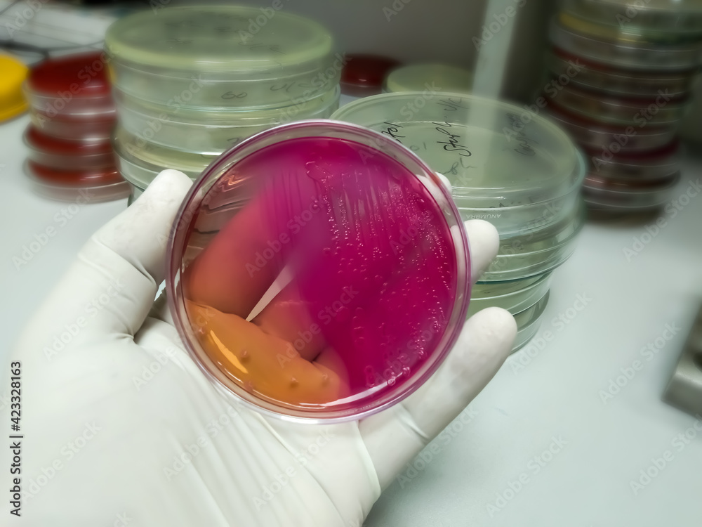 Foto de Hand holding MacConkey agar plate which contain pink colonies ...
