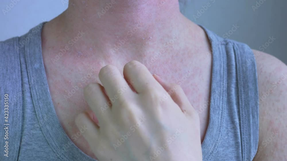 A close-up video shows the woman upper chest and shoulder. In these ...