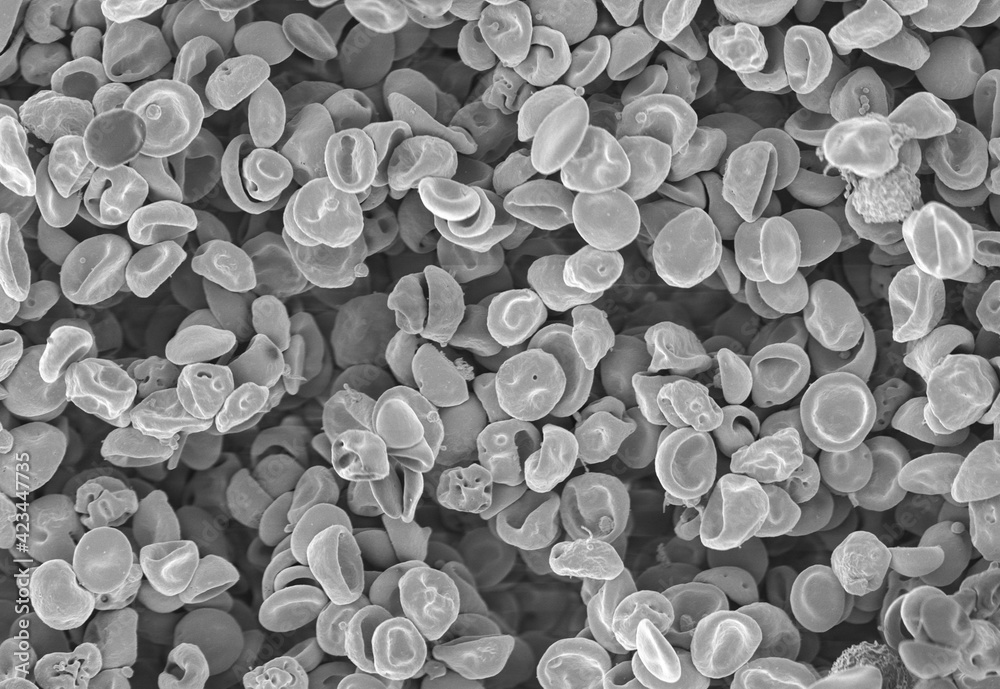 Scanning electron microgram of a blood sample taken from a Plasmodium ...