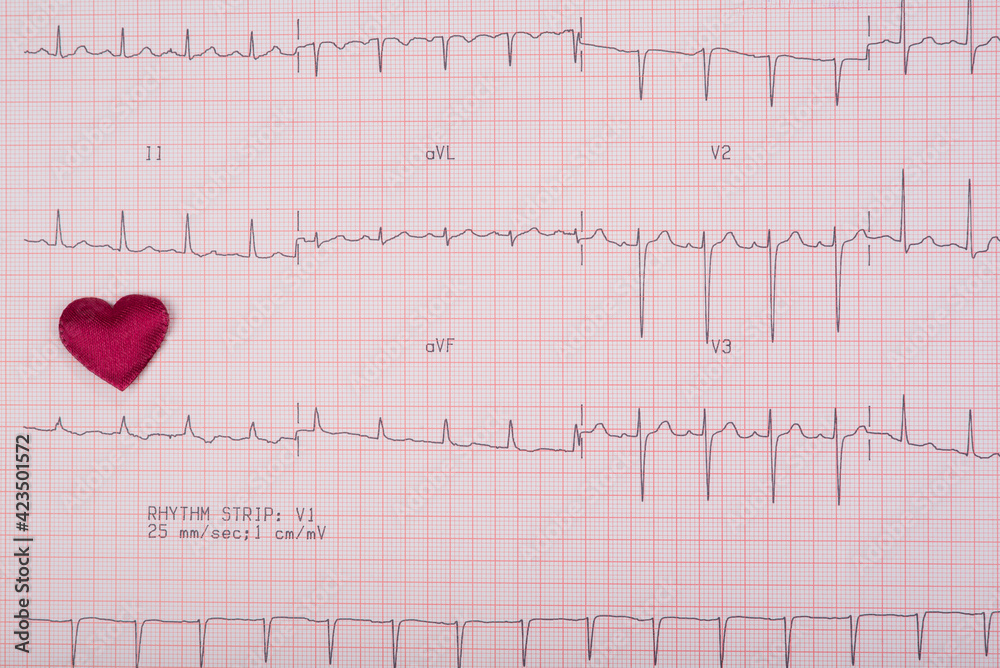 ECG graph with a heart. Rhythm strip. Stock Photo | Adobe Stock