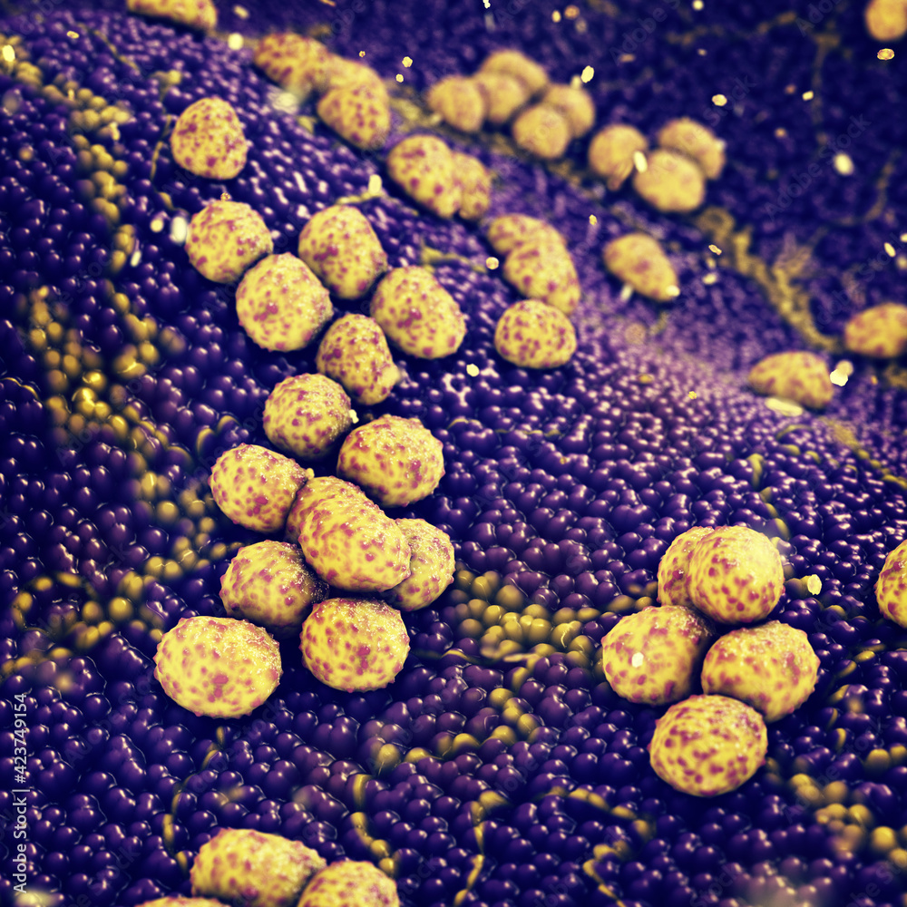 Colony of Staphylococcus aureus bacteria. Staph infections and ...