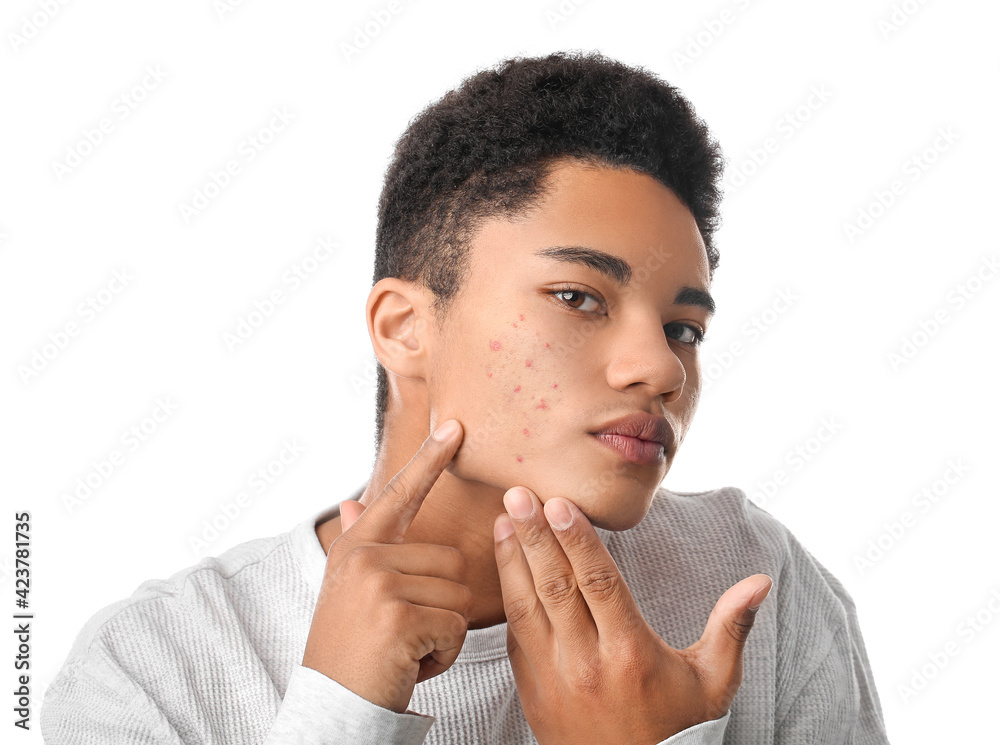 African-American teenage boy with acne problem on white background ...