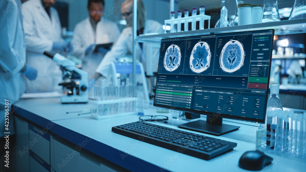 Shot of Desktop Computer with Running Software of MRI Brain Analysis ...