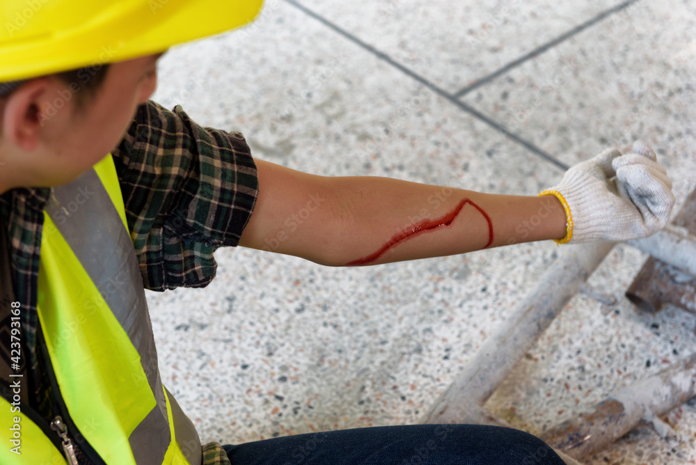 Injury bleeding from work accident in pile of scaffolding steel falling ...