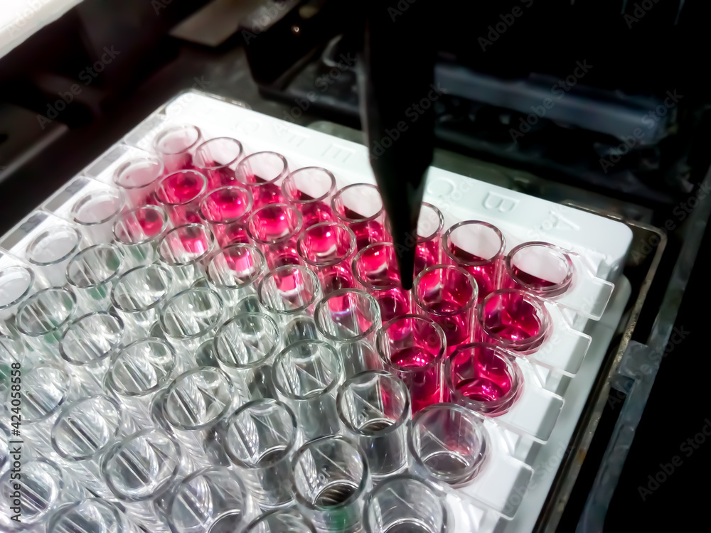 Foto de Enzyme-linked Immunosorbent assay (ELISA) plate, Immunology or ...