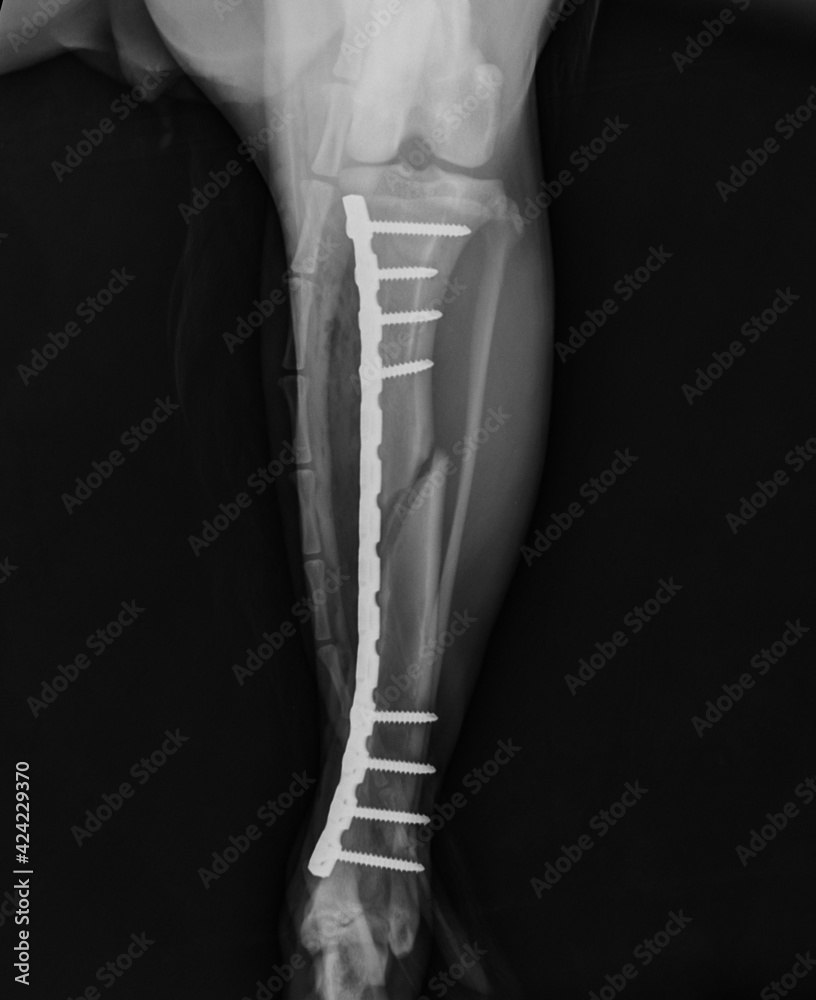 X ray of a dog tibial fracture repair using plate and screws. Dog ...