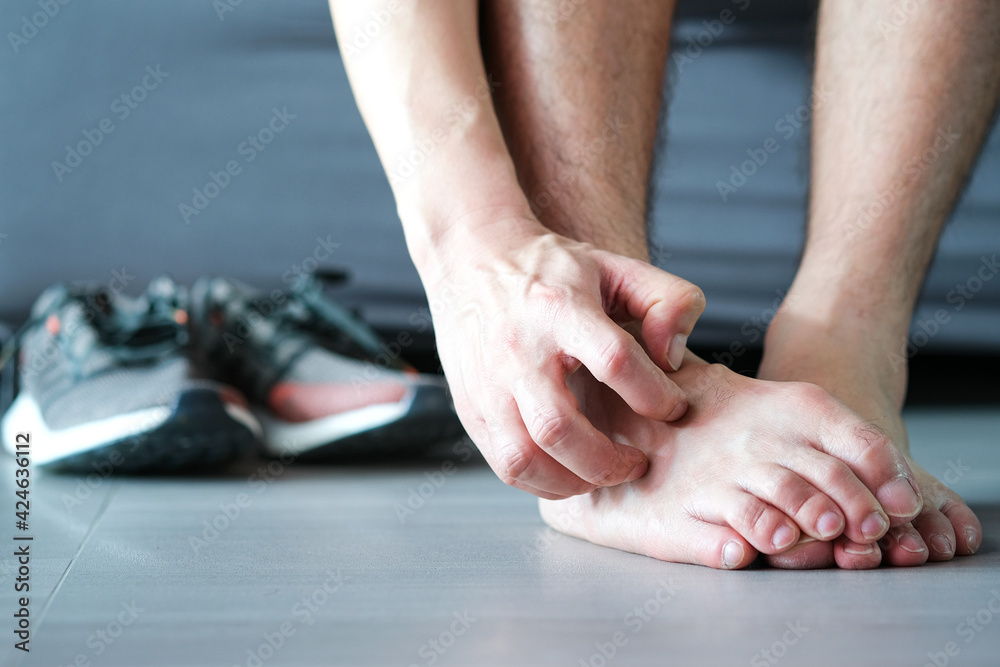 Men wear canvas shoes, he scratches legs and feet with itchy skin ...