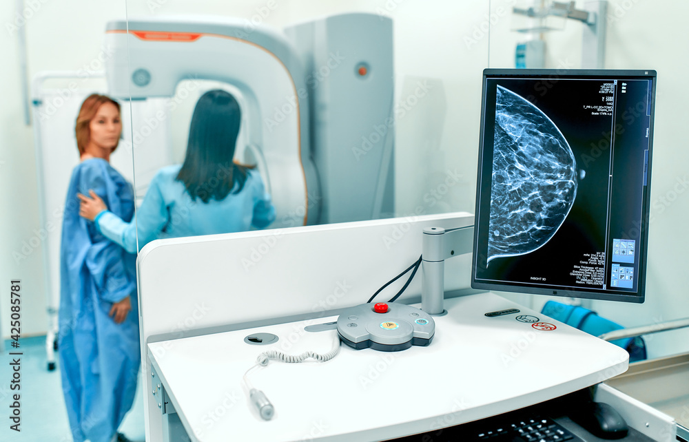 Mammogram snapshot of breasts of a female patient on the monitor with ...