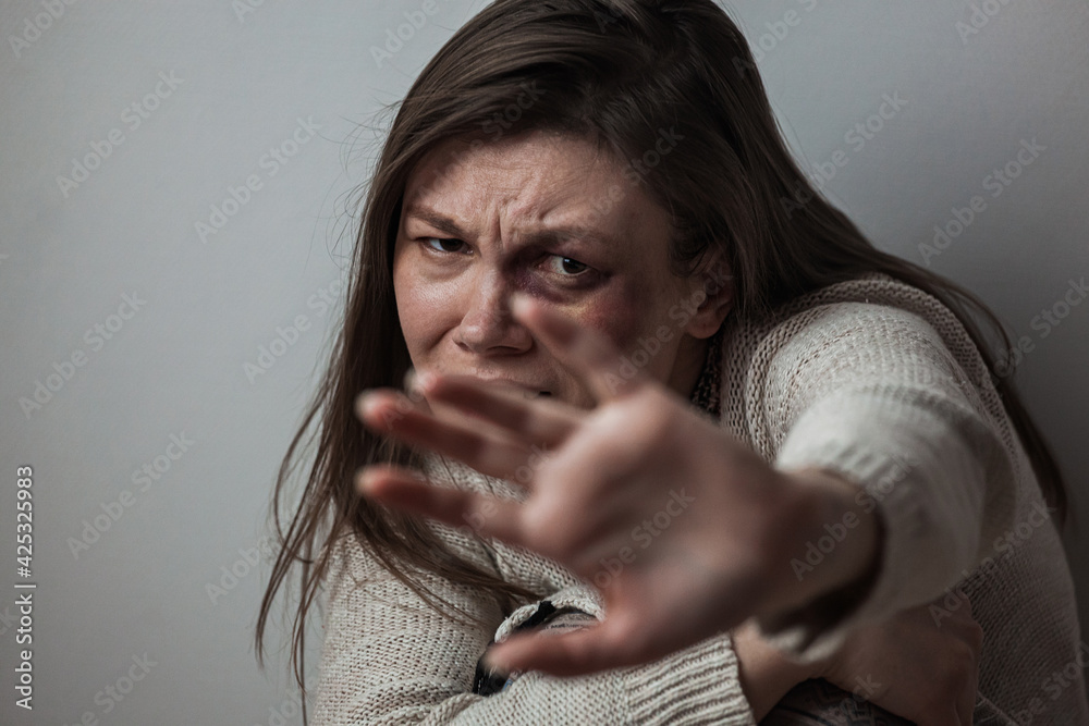 Domestic violence, abuse woman with bruise on face fear, and defending ...