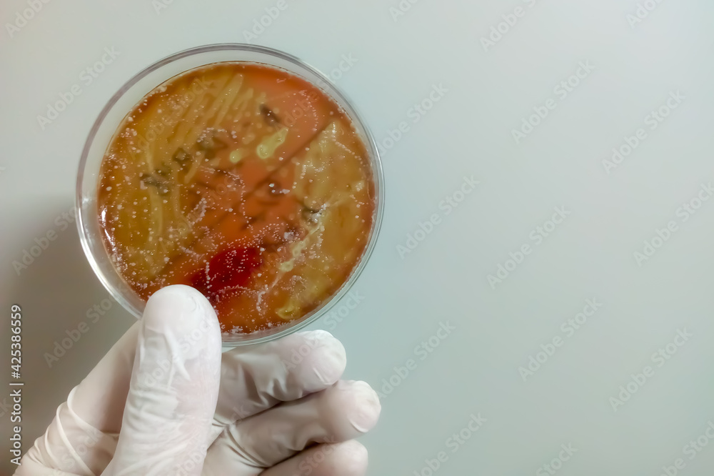 Microbiologist hand hold a Petrie dish with a mixed culture of bacteria ...