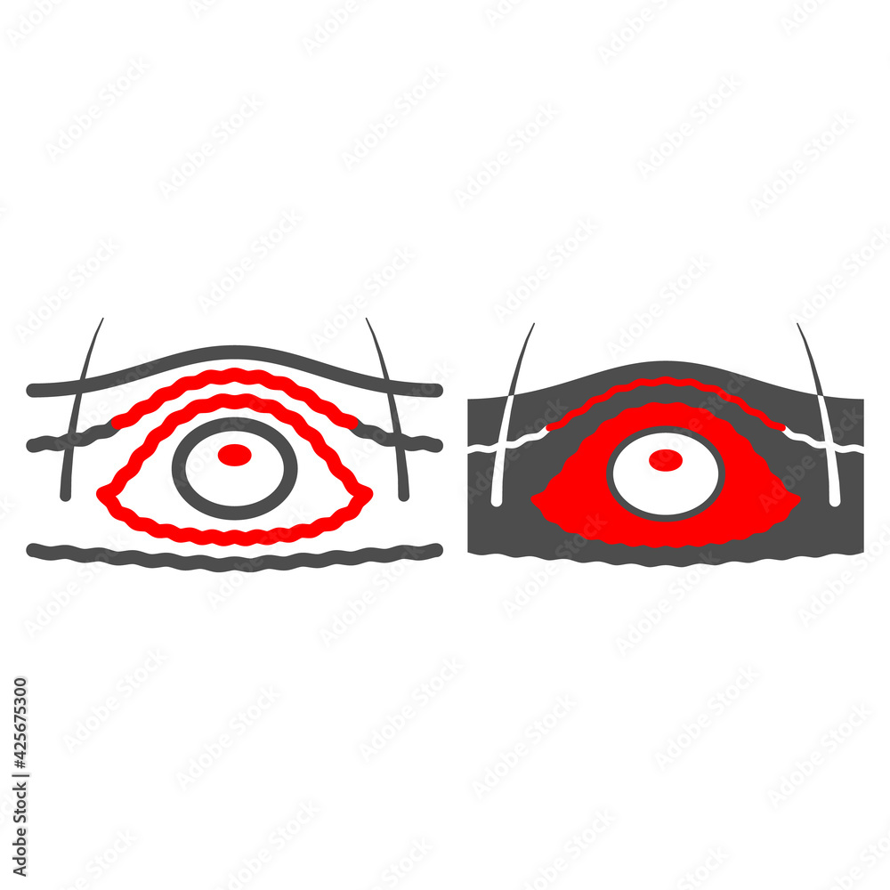 Inflammation of connective tissue line and solid icon, Human diseases ...