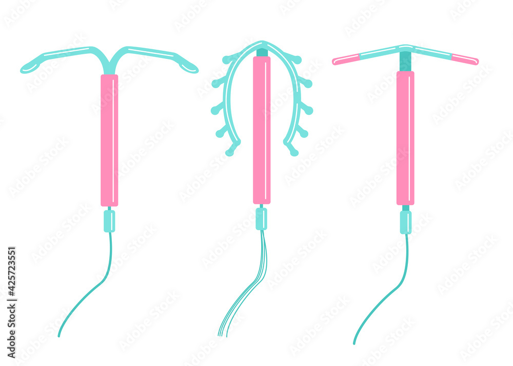 The method of IUD contraception is not isolated. Control and protection ...
