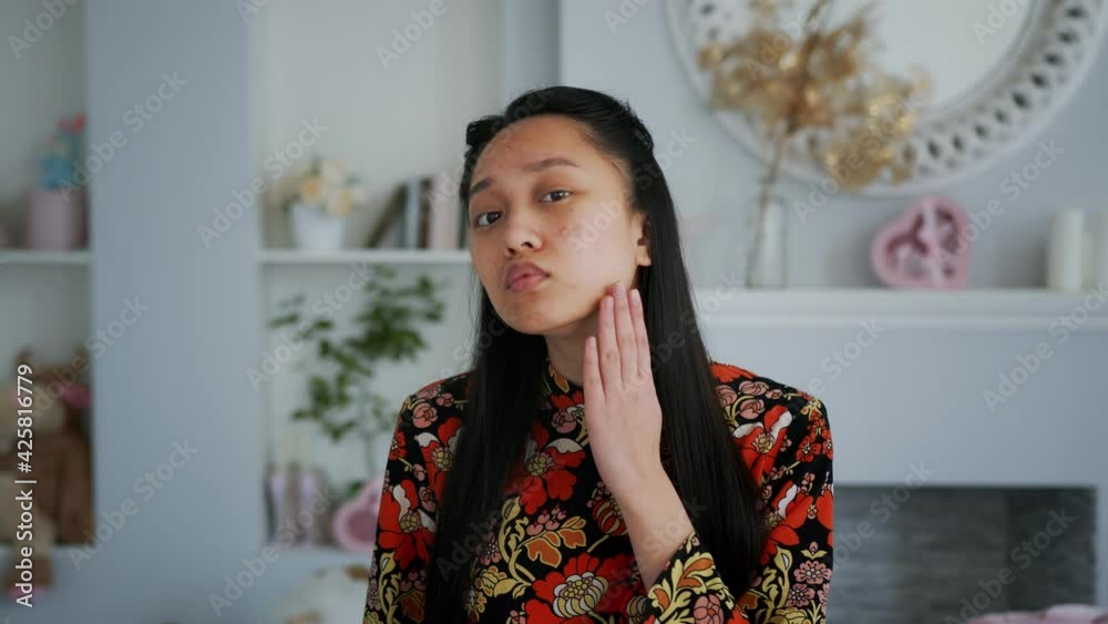 Young Asian Beautiful Girl with problem skin. Acne treatment stages ...