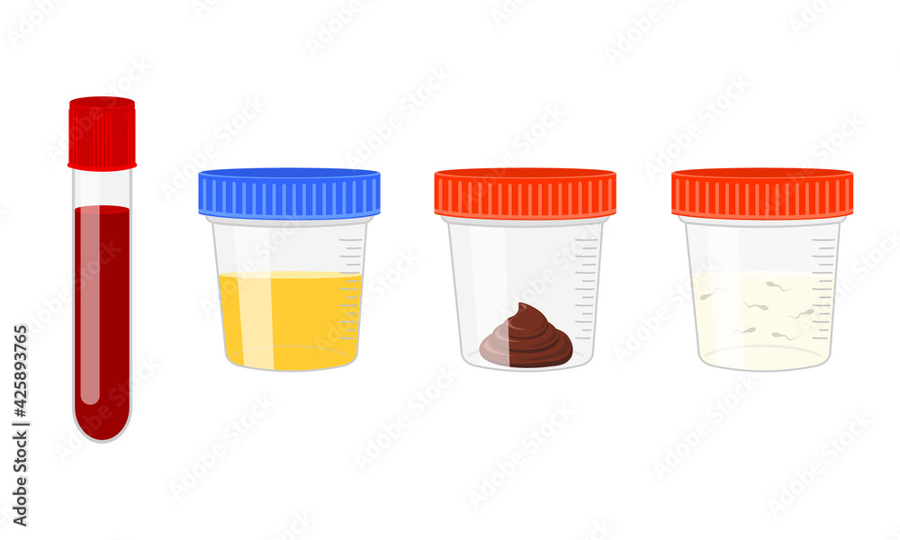 Medical tests of blood, urine, stool, sperm. Urinalysis, blood, poo and ...
