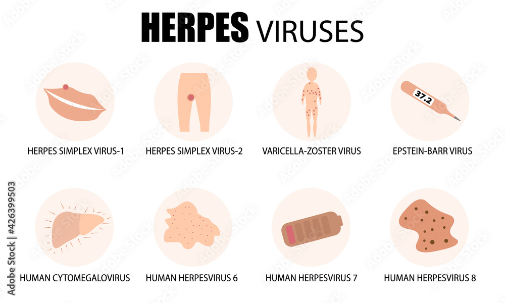 Herpes viruses. Classification, types, and symptoms of human herpes. Medical poster, banner ...