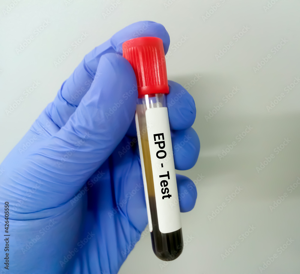 Blood sample for EPO (Erythropoietin) test, stimulating hormone for RBC ...