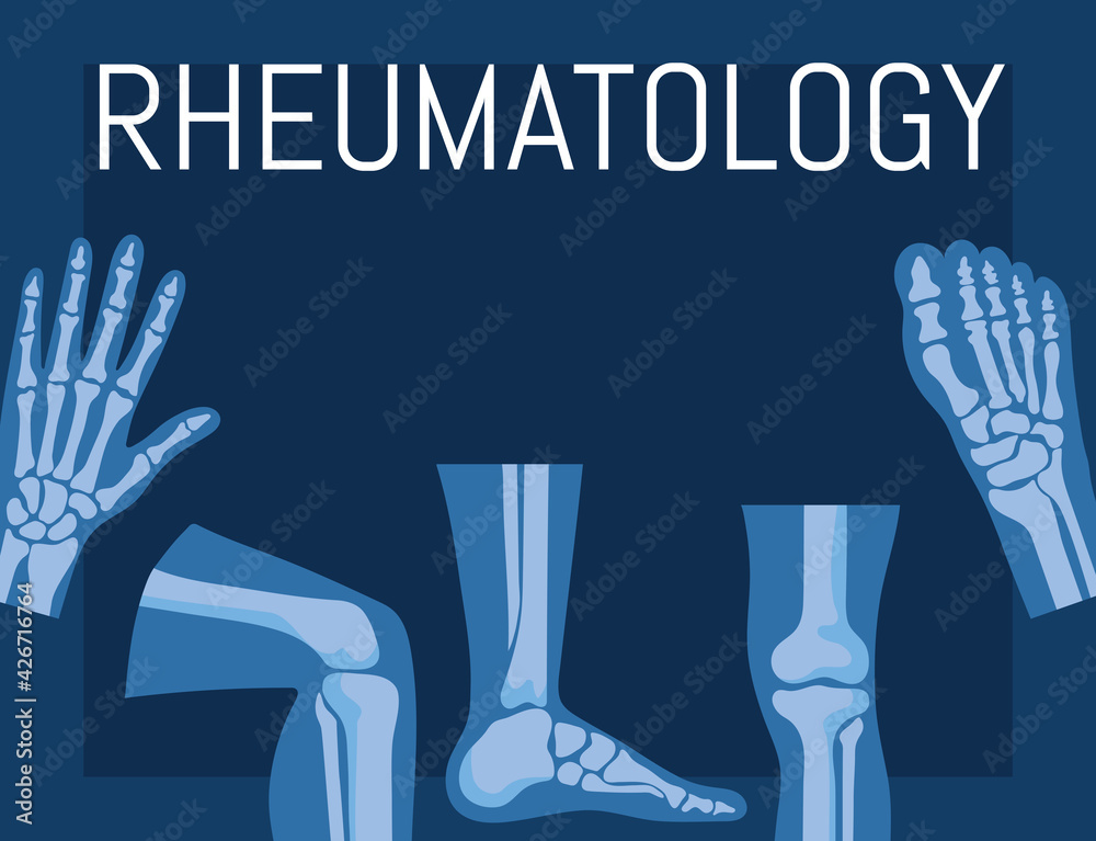 rheumatology bones poster Stock Vector | Adobe Stock