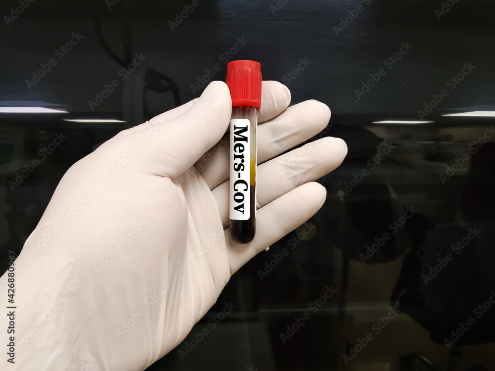Blood sample for Virus Panel test, diagnosis for viral disease Stock ...