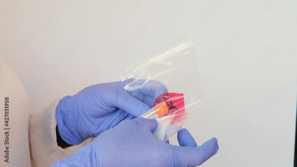 girl holds a kit for a dna test in a box, a cotton swab for scraping ...