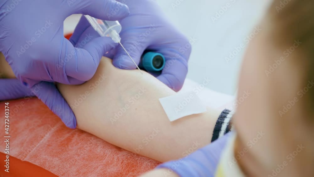 Syringe needle pierces patient skin in hospital lab to draw blood from ...