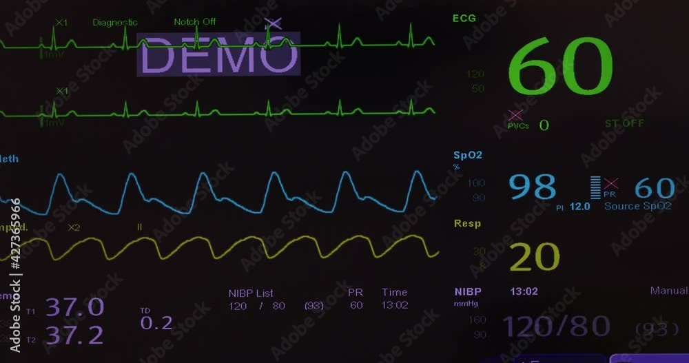 Digital vital signs monitoring with EKG, blood pressure, pulse rate ...