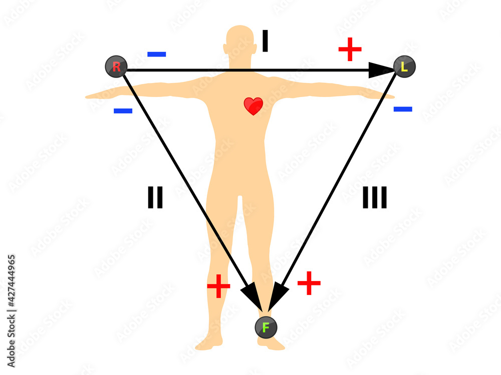 Póster Einthoven ECG triangle, including augmented unipolar limb lead ...