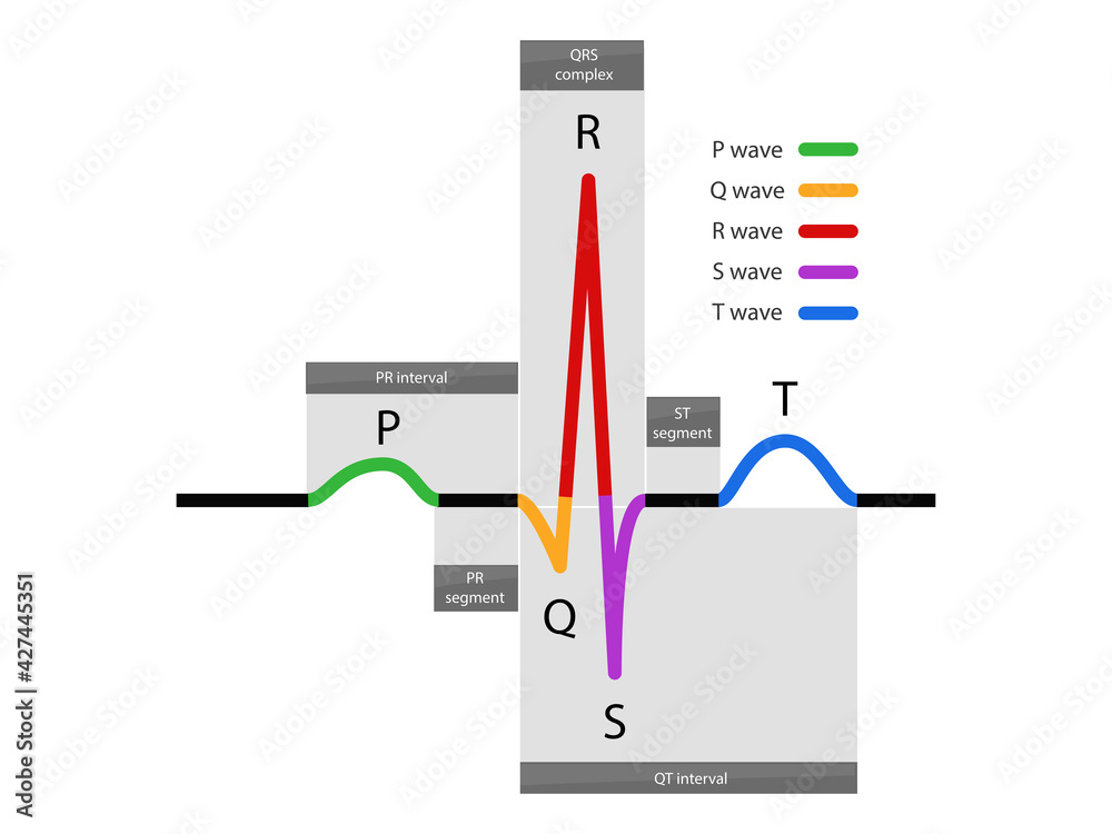 ecg waveform, Normal Atrial And Ventricular Depolarization With ...