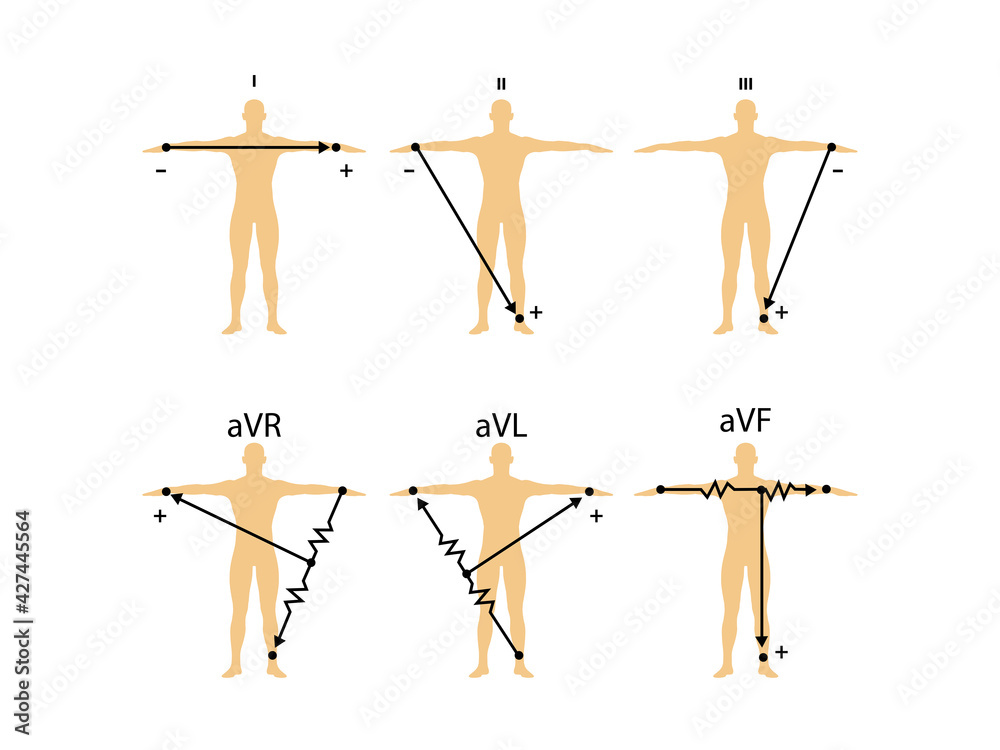 Einthoven ECG triangle, including augmented unipolar limb lead Stock ...