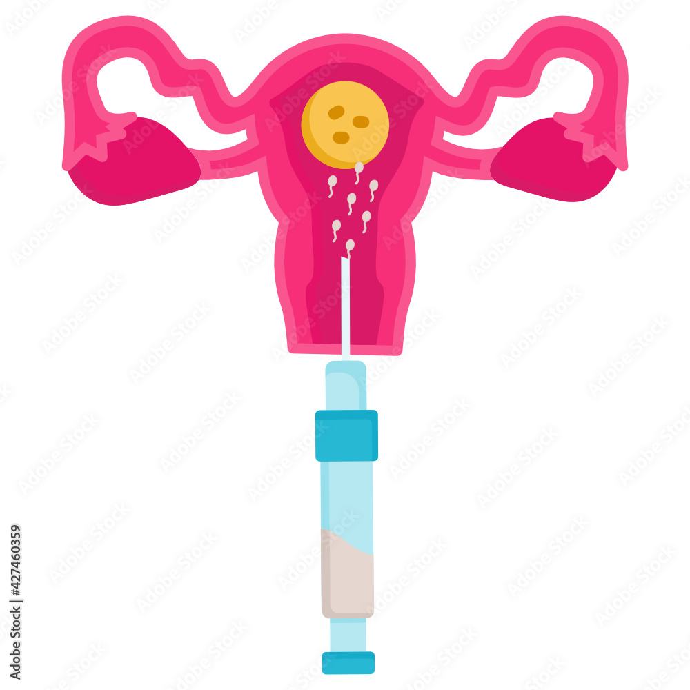 Artificial insemination Vector Icon Design, In Vitro Fertilization ...