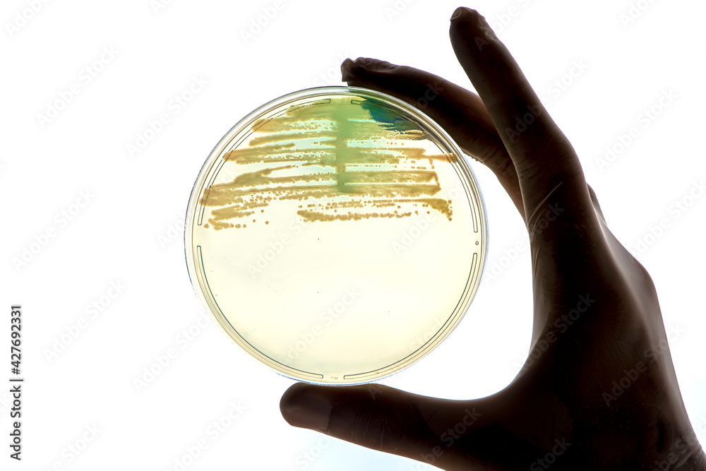 Laboratory technician tests for bacterial infection analyzes bacterial ...