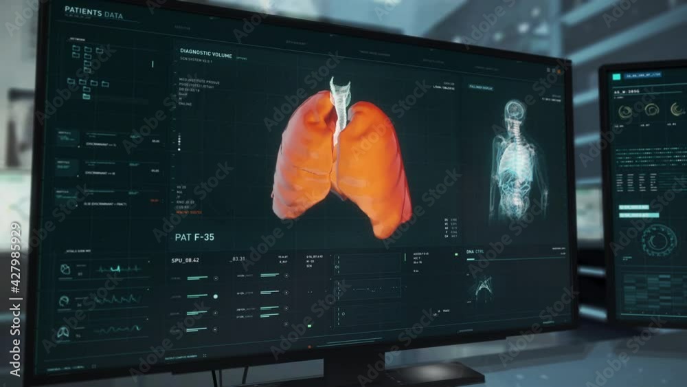 Computer User Interface. Medical Research Laboratory. The Patient`s ...