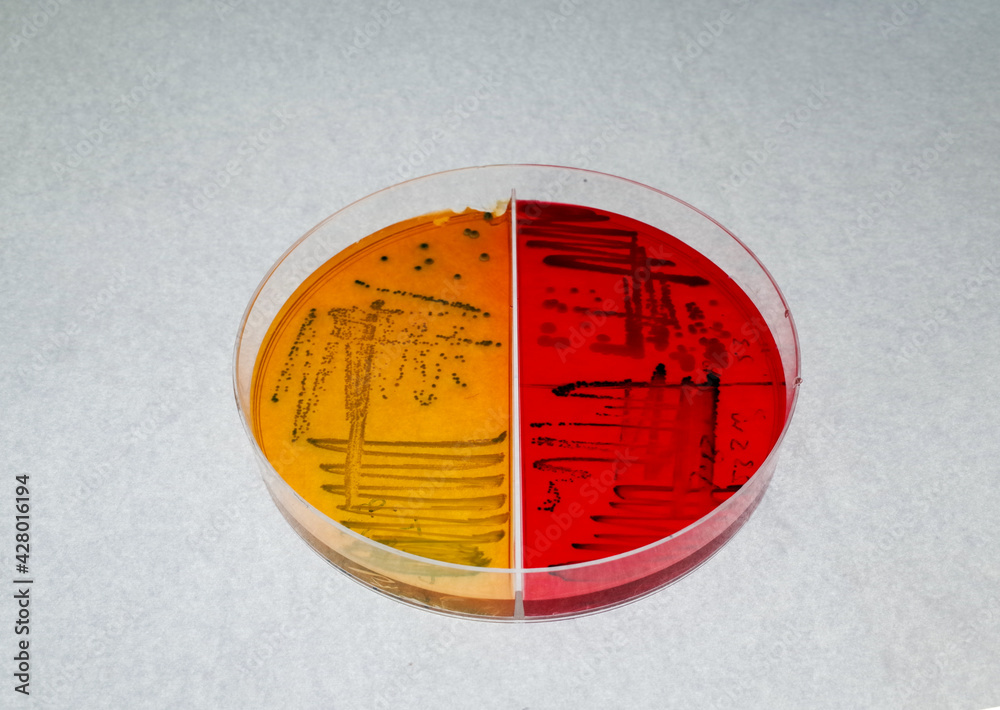 laboratory dish contain growth of colored bacterial colonies on ...