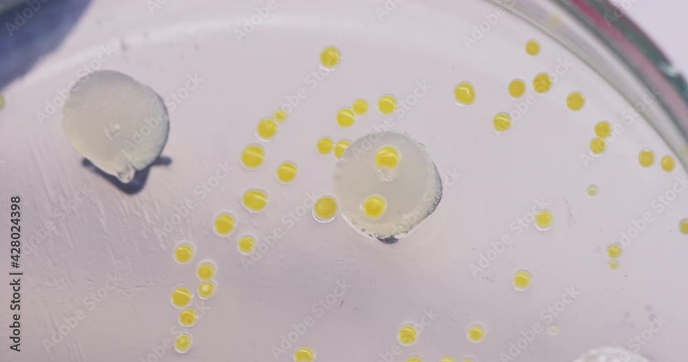 Stockvideo Colonies of yellow bacteria on nutrient agar in a petri dish ...
