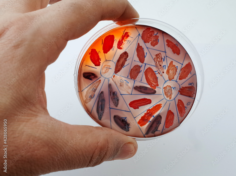 grwoth of different bacterial species on congo red agar plate to detect ...