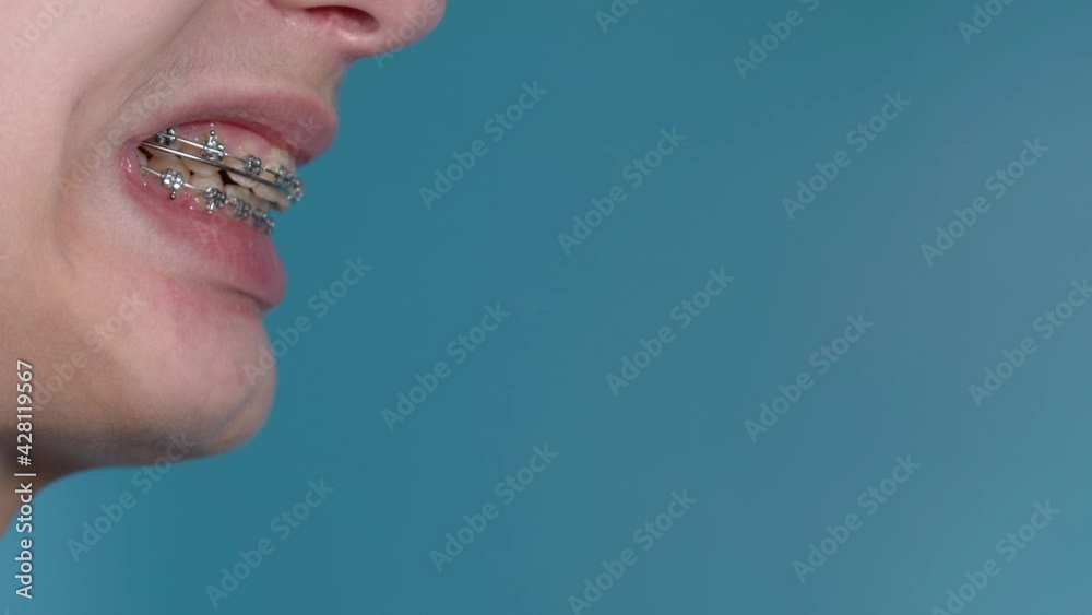 Closeup view 4k stock video footage of profile view of smiling mouth of ...