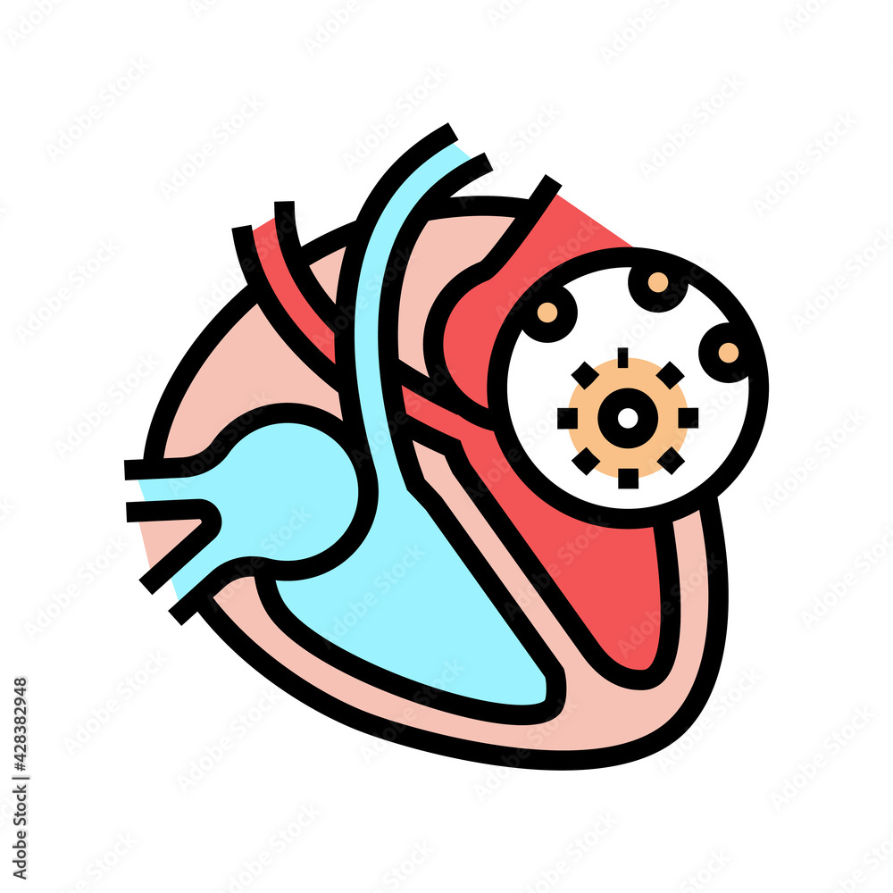 myocarditis disease color icon vector. myocarditis disease sign ...