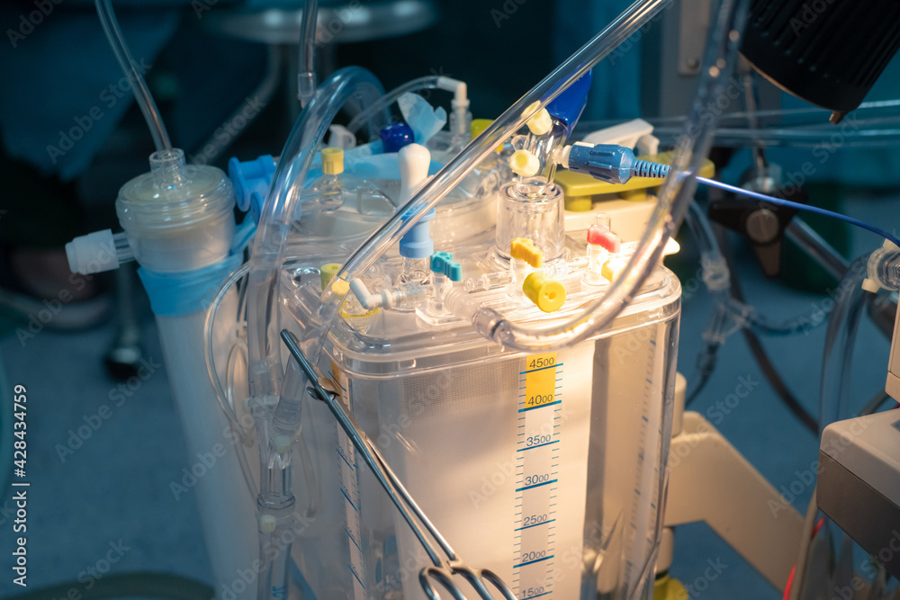 Heart lung machine for heart surgery in operating room. Roller pumps of ...