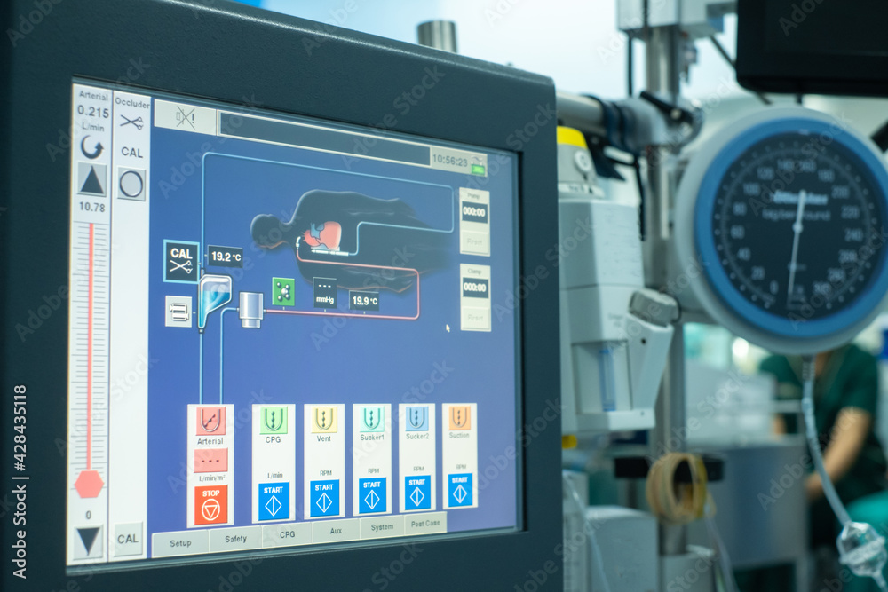 Electrocardiogram in hospital surgery operating emergency room showing ...