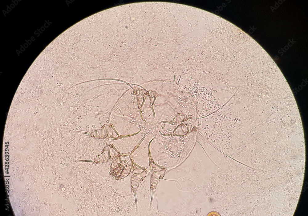 Dermatophagoides Farinae D2 Alto - RETOEDU