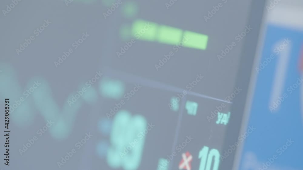 Close-up of heart cardiogram machine. Action. Screen with stable ...