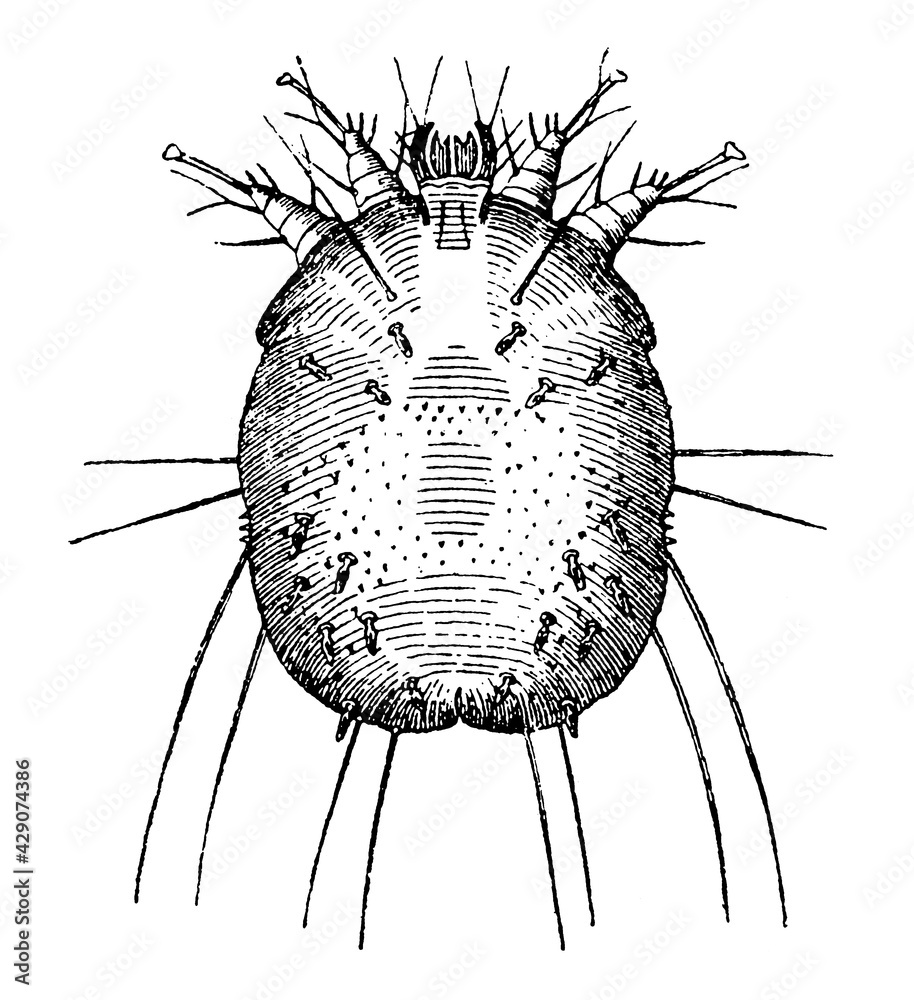 Sarcoptes scabiei. Illustration of the 19th century. Germany. White ...