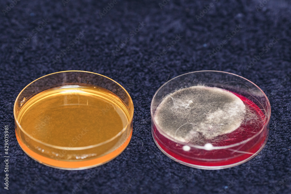 bacterial inoculation in laboratory dishes, grown colonies of bacteria ...