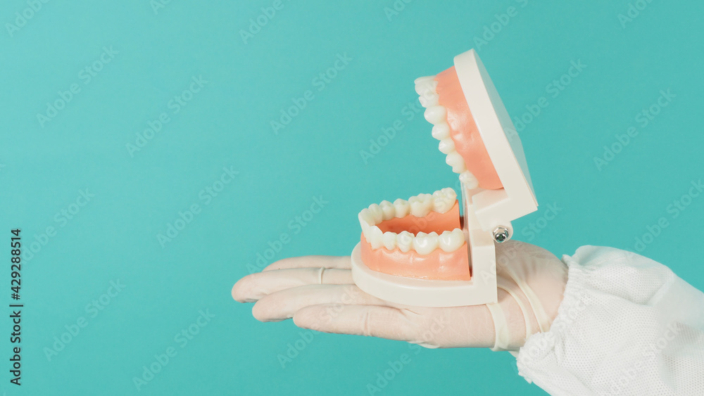 Foto de Orthodontic model of teeth in hand that wearing medical glove ...
