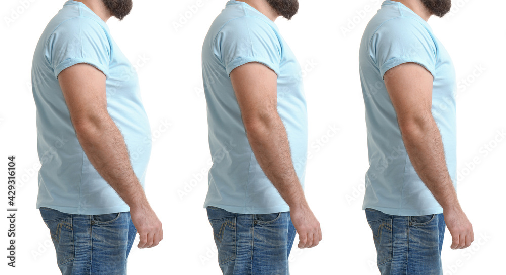 Man before and after weight loss on white background, collage Stock ...