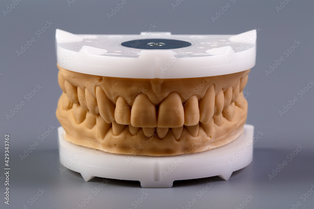 Mold of teeth. Gypsum model plaster of teeth. Stomatologic plaster cast ...