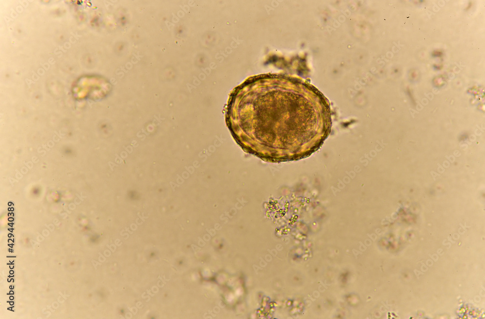 Roundworm Eggs In Humans