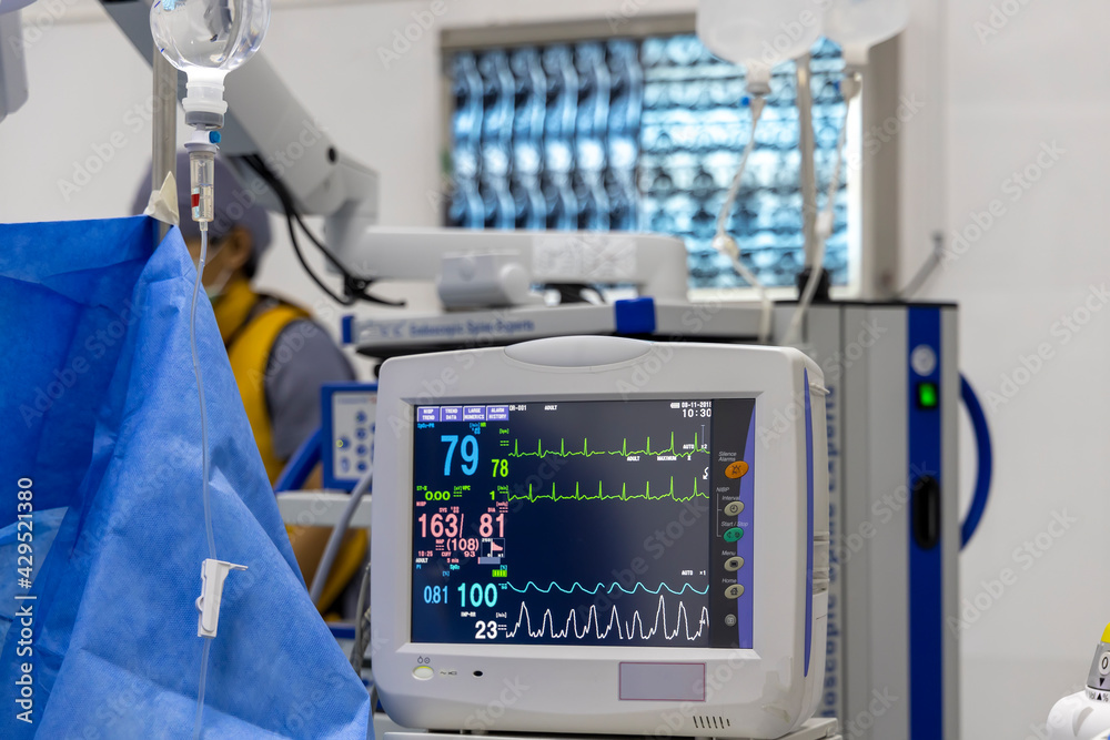 Vital sign monitoring screen inside modern operating room in hospital ...