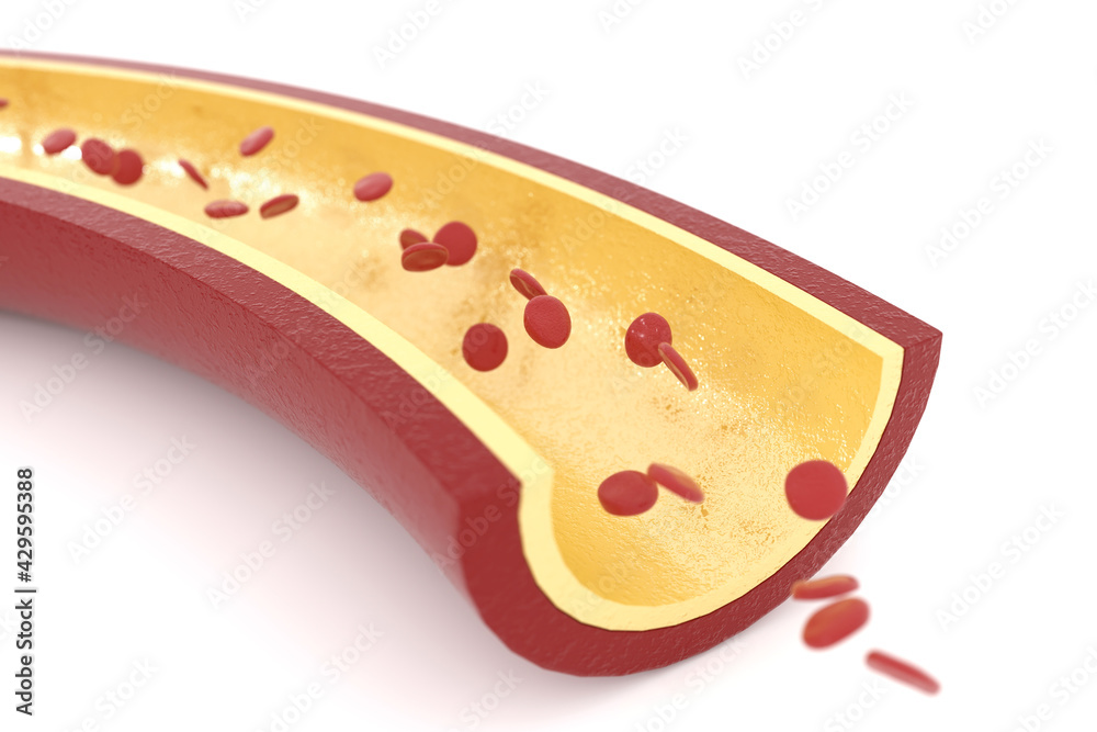 3d rendered model of blood vessels and platelets Stock Illustration ...