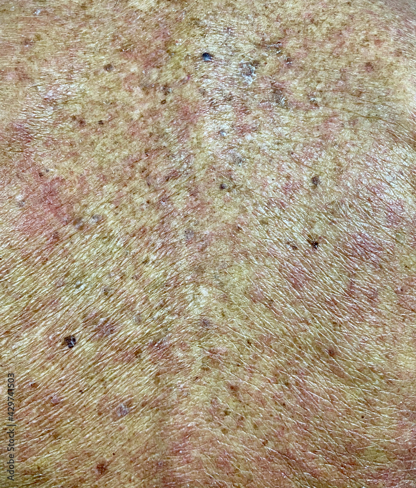 The texture of old man's skin. Can see the details of the skin color ...